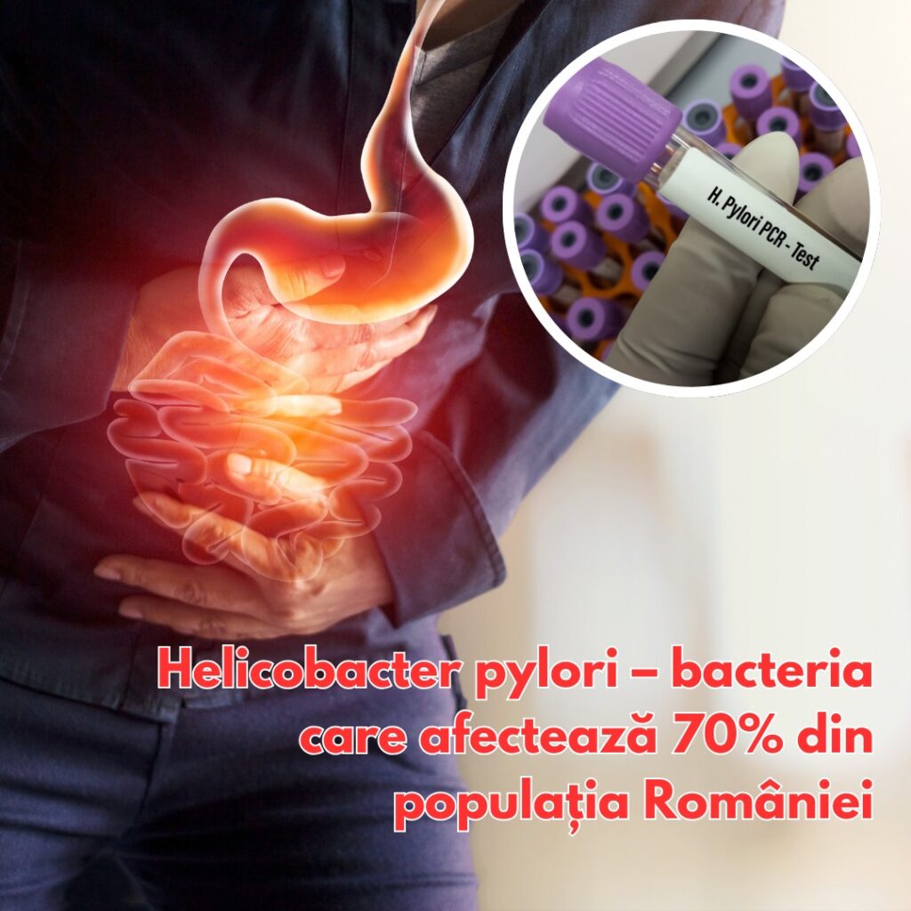 Helicobacter pylori – bacteria care afecteaza 70% din populatia Romaniei – Eumed Blog